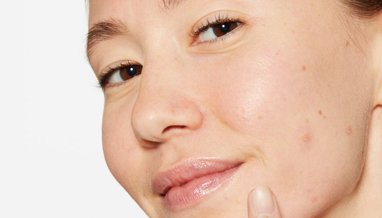 Types Of Spots And How To Treat Them – Dermalogica UK